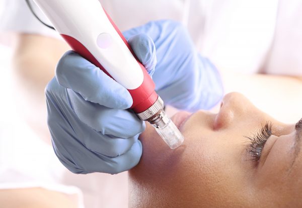 Mesotherapie Microneedling - aArt